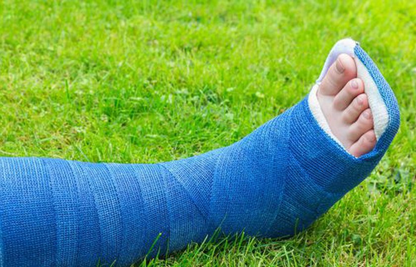 Serial Casting & Tees Neurophysiotherapy